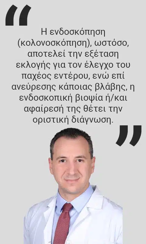 Καρκίνος Παχέος Εντέρου | Συμπτώματα, Στάδια & Θεραπεία