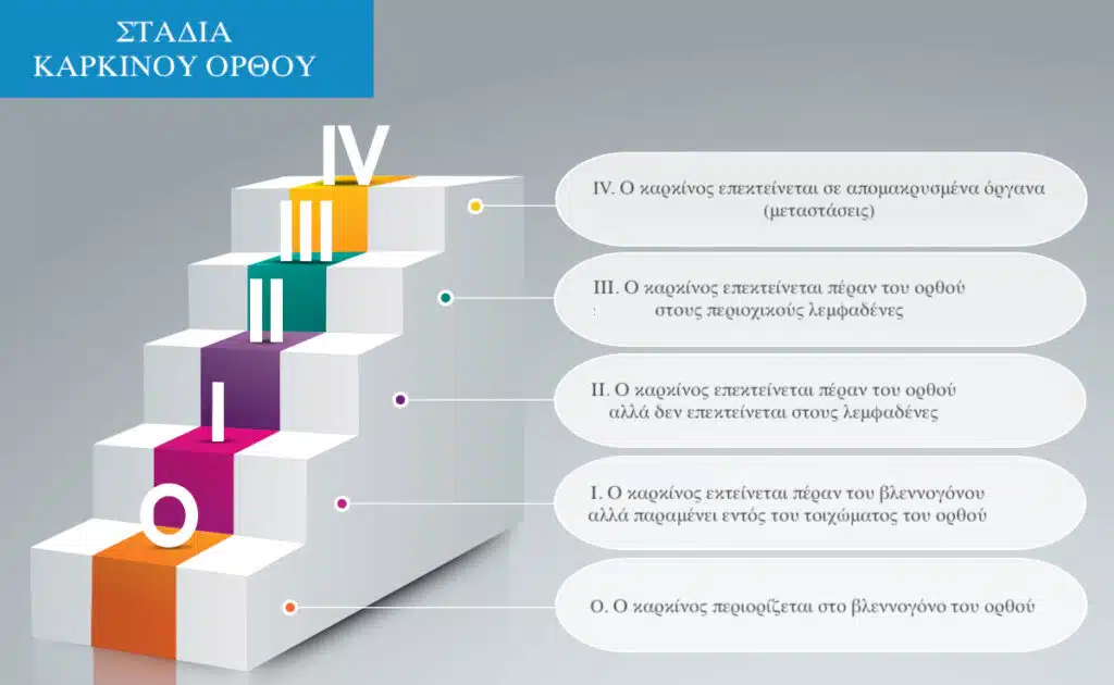 Καρκίνος Ορθού | Συμπτώματα, Στάδια & Οριστική Θεραπεία